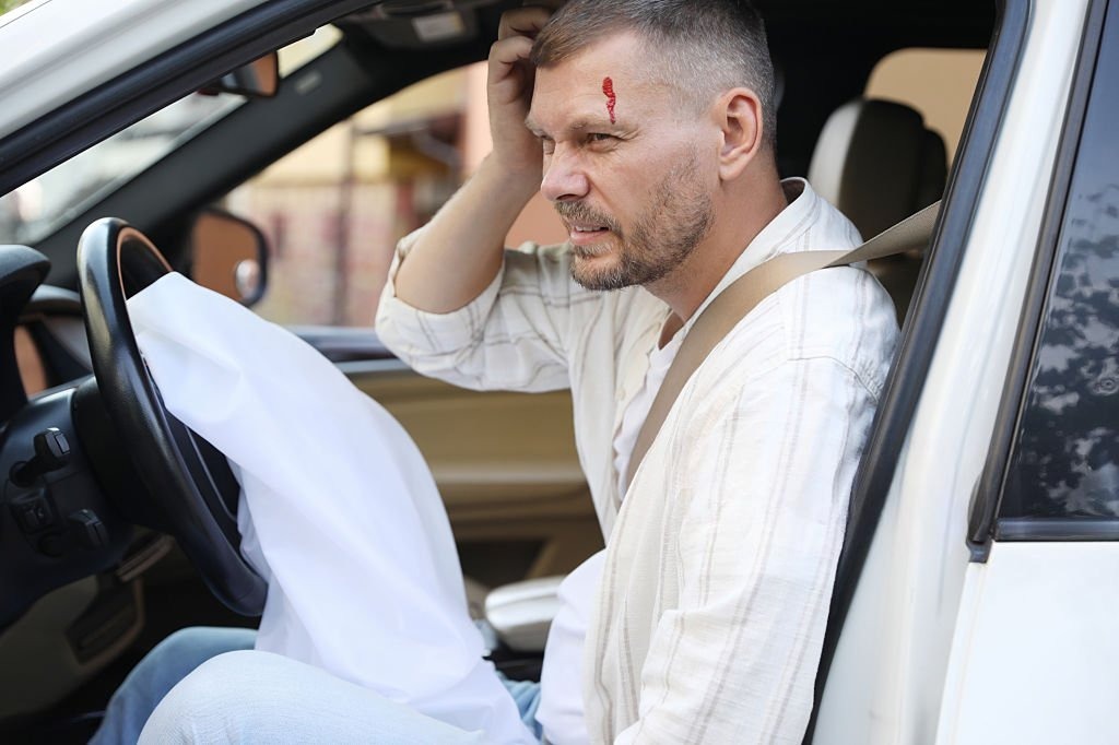 Facial Scars from Car Accidents: Legal and Medical Implications ...